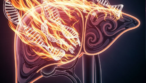 Why Fatty Liver ‘Cure’ Might Be a Time-Bomb: Scientists Warn Against ...